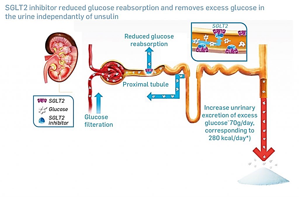 CƠ CHẾ TÁC DỤNG CỦA NHÓM ỨC CHẾ SGLT-2 - Tin chuyên môn & NCKH - Khoa Dược - Đại học Duy Tân